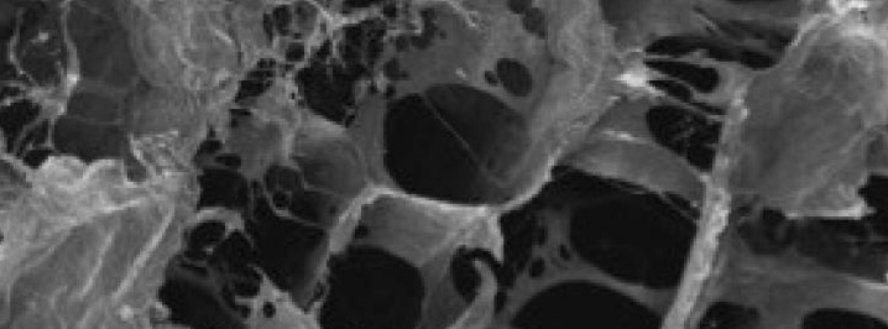 Polymers and Biomaterials | Department of Materials